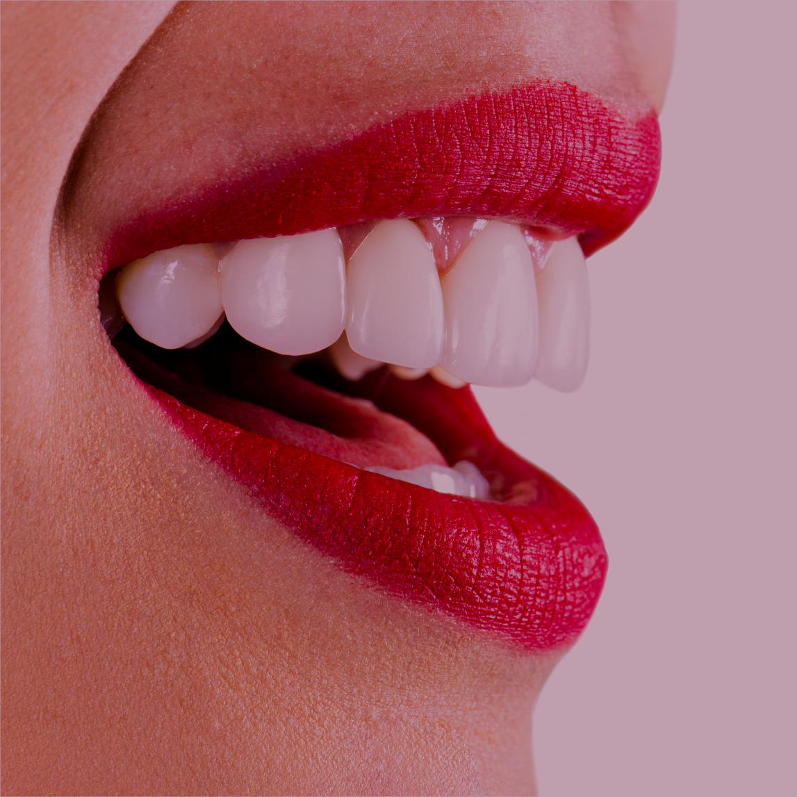 Cómo conseguir dientes más blancos – blanqueamiento - OdontoCenter ...